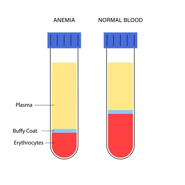 Blood structure concept Stock Vector by ©Pikovit 471698480