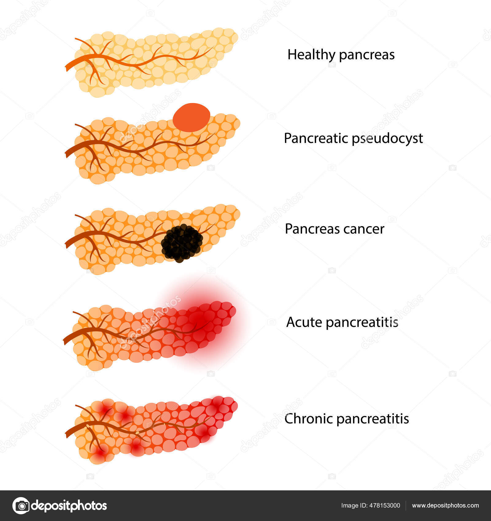 Real Healthy Pancreas