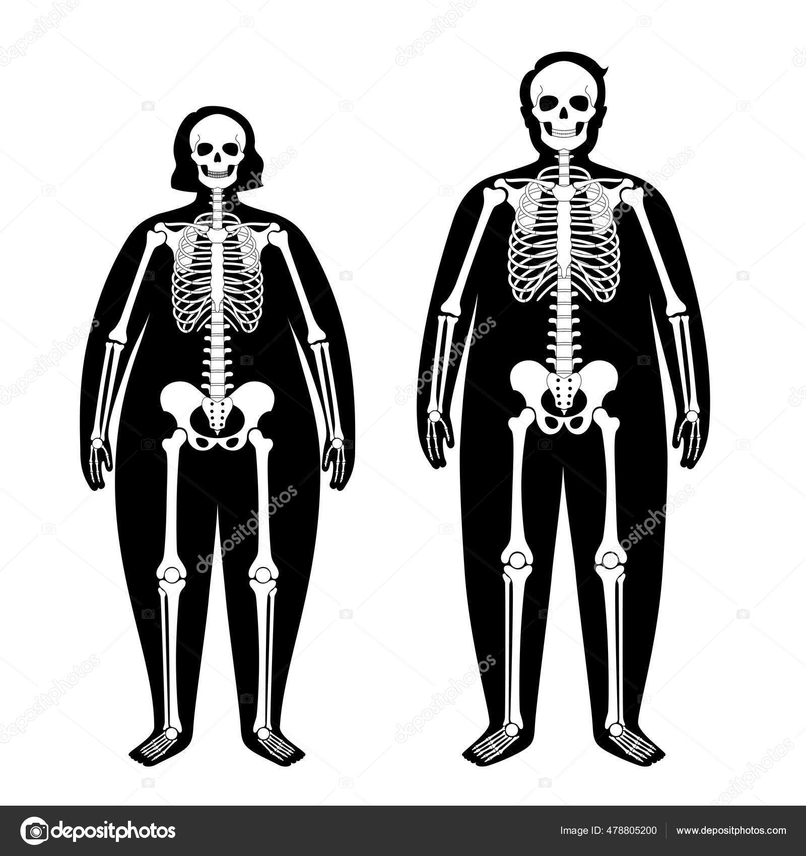 Anatomie des fettleibigen Skeletts Stock-Vektorgrafik von ©Pikovit ...