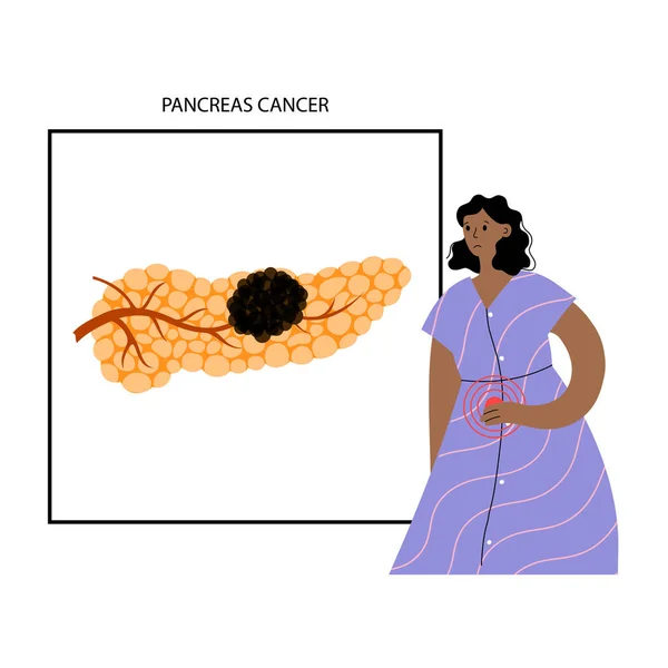 Pancreas disease and cancer Stock Vector by ©Pikovit 479007278