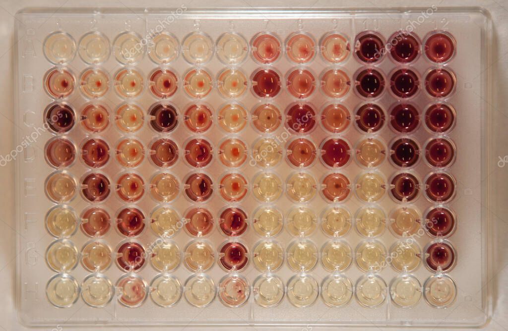 Resultados de un experimento colorimétrico de laboratorio con ...