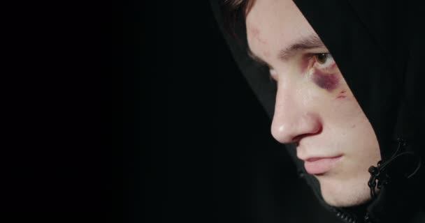 58 Hemorragia ocular Videos, Royalty-free Stock Hemorragia ocular ...