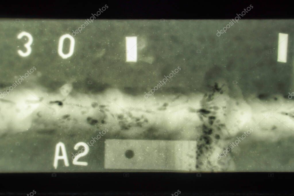 Costura soldada. Imagen de rayos X con defectos en forma de poros ...