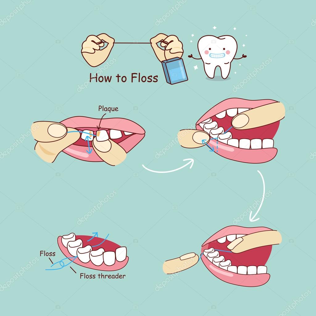 Cómo utilizar el hilo dental — Vector de stock © etoileark #110142680