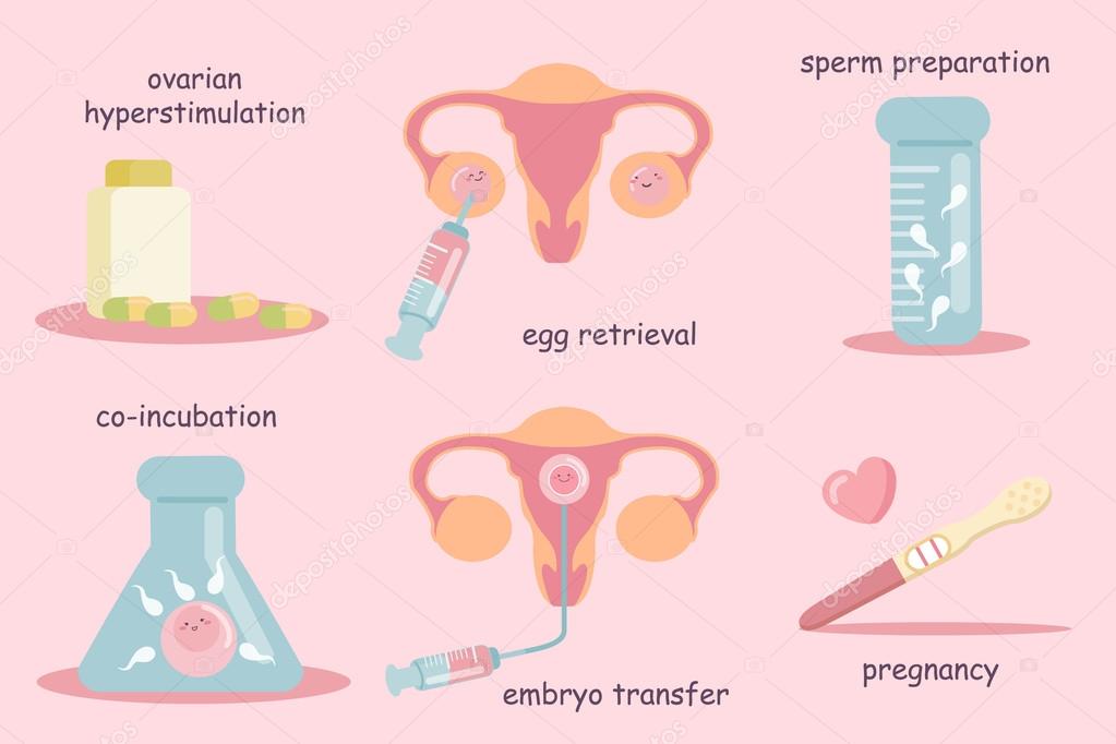 IVF relate concept — Stock Vector © etoileark #96657206 IVF relate concept — Stock Vector © etoileark #96657206