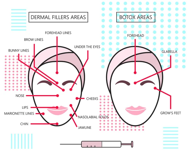 91 Dermal fillers Vectors, Royalty-free Vector Dermal fillers Images ...