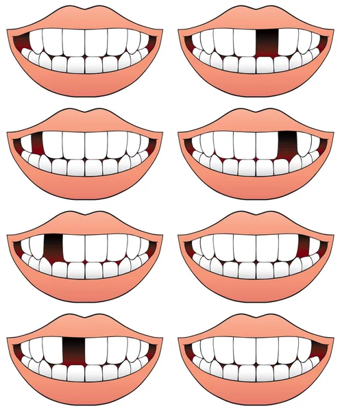 Missing teeth Vector Art Stock Images | Depositphotos