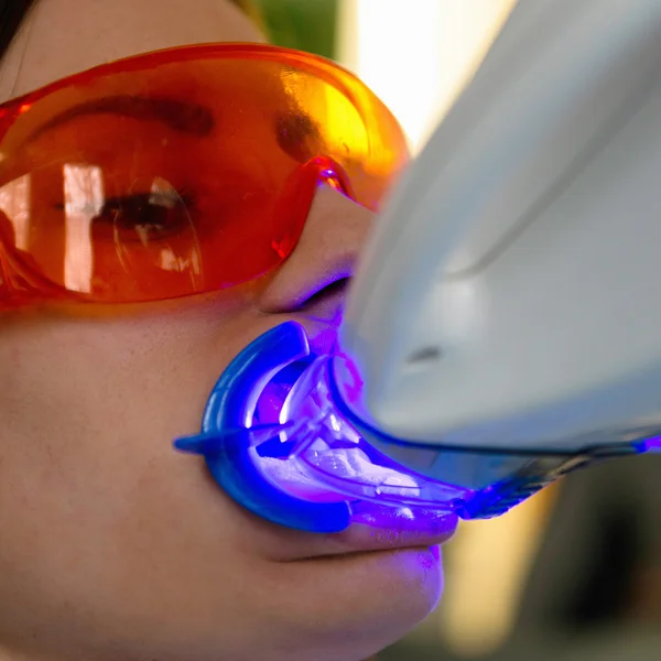 Teeth whitening procedure Stock Photos, Royalty Free Teeth whitening ...