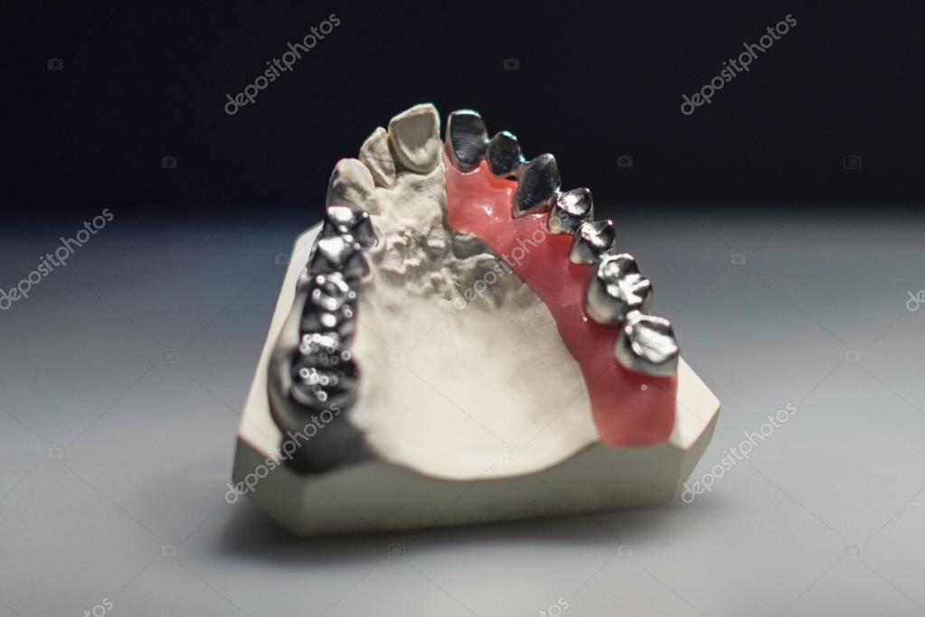 Denture anatomical model Stock Photo by ©microgen 115993350