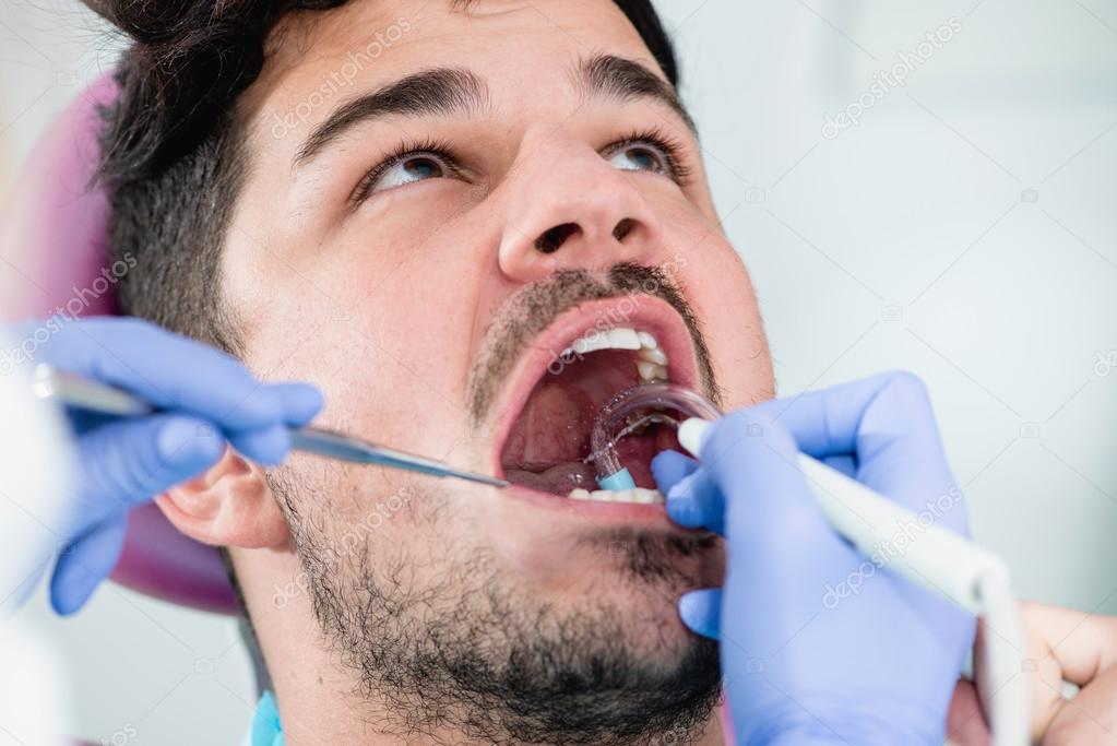 Man during Professional teeth cleaning Stock Photo by ©microgen 115994190