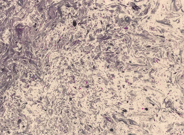 Pathology collection Stock Photos, Royalty Free Pathology collection ...