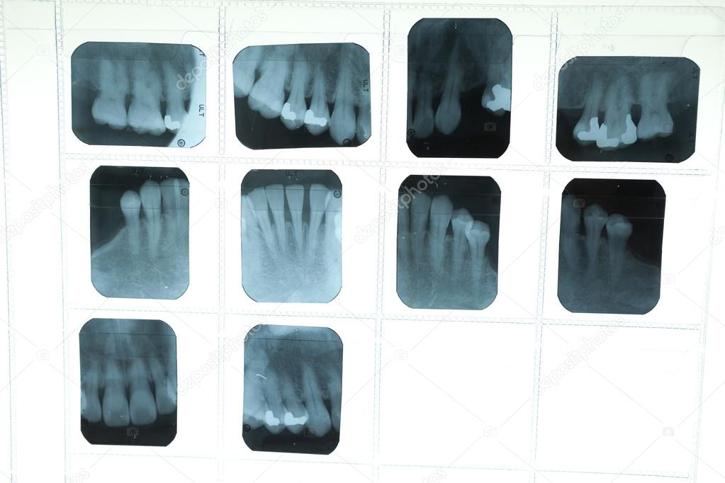 Película de rayos X dental panorámica para dentista 2024