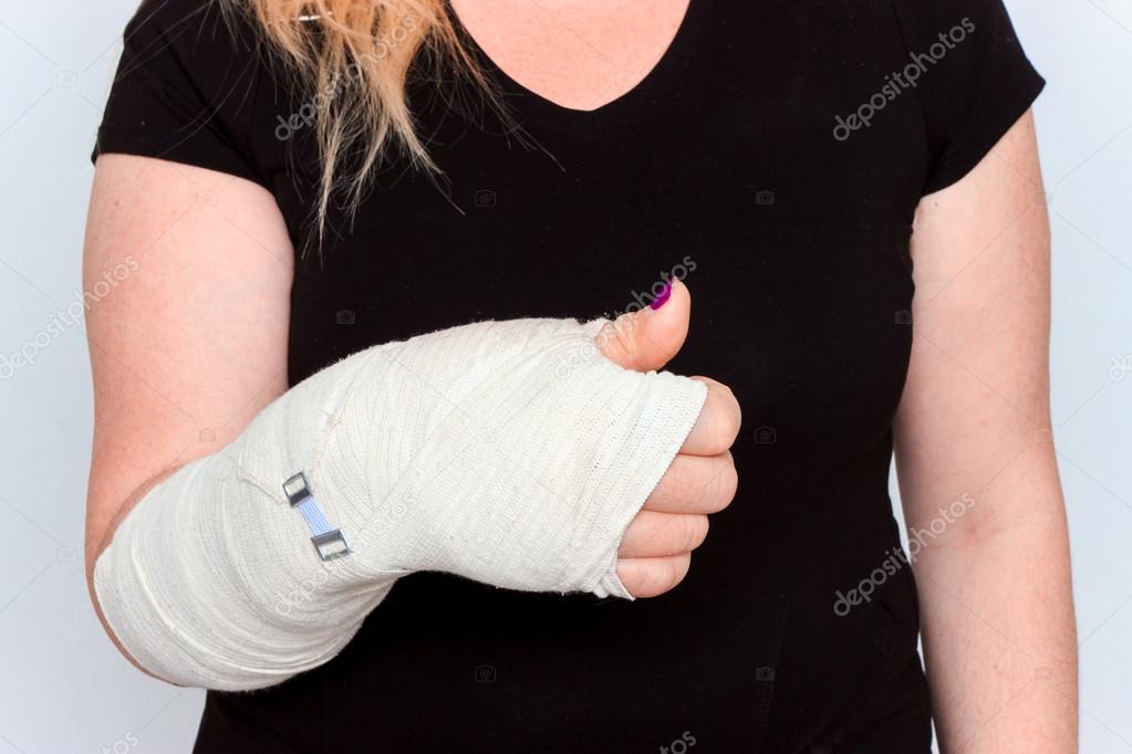 Broken Hand Cast Girl