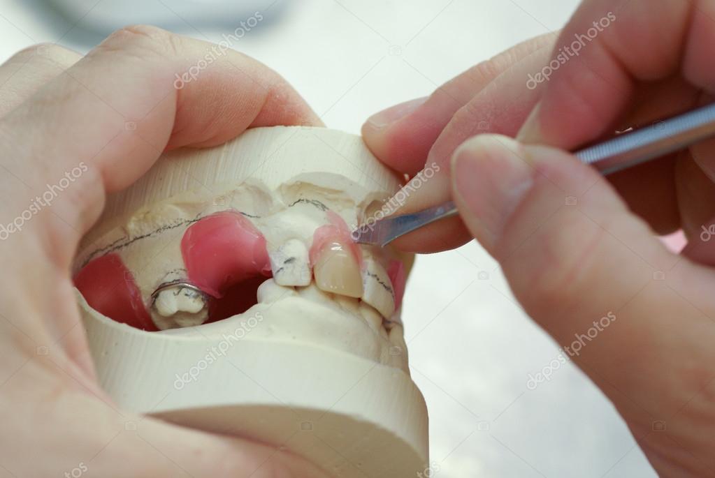 Nuevas prótesis dentales con modelo de yeso dientes postizos 2023