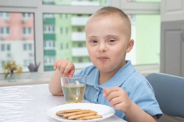 Little Boy Genetic Disease Syndrome Sitting Table Eating Child Himself ...