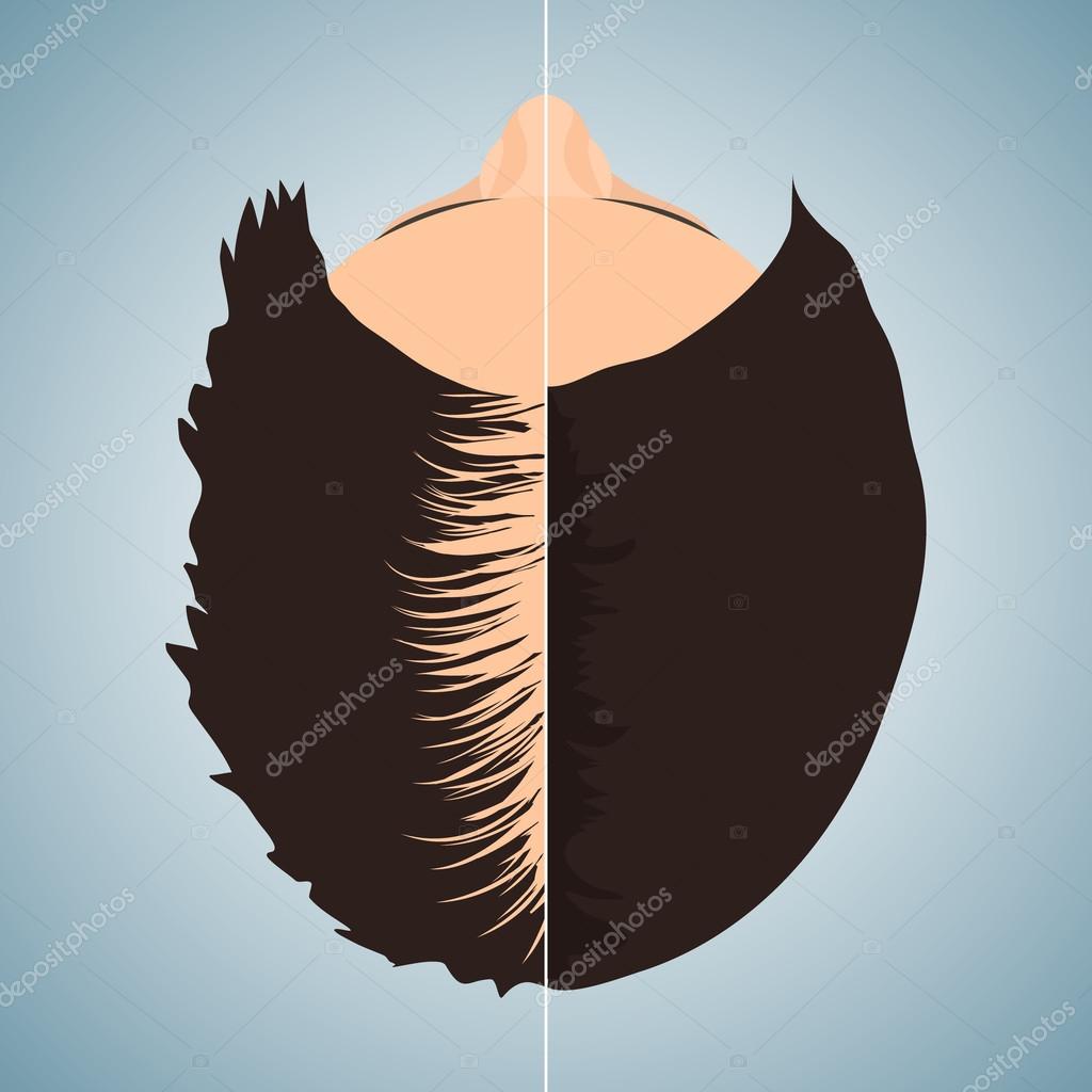 Mujer calva antes y después del tratamiento del cabello 2022