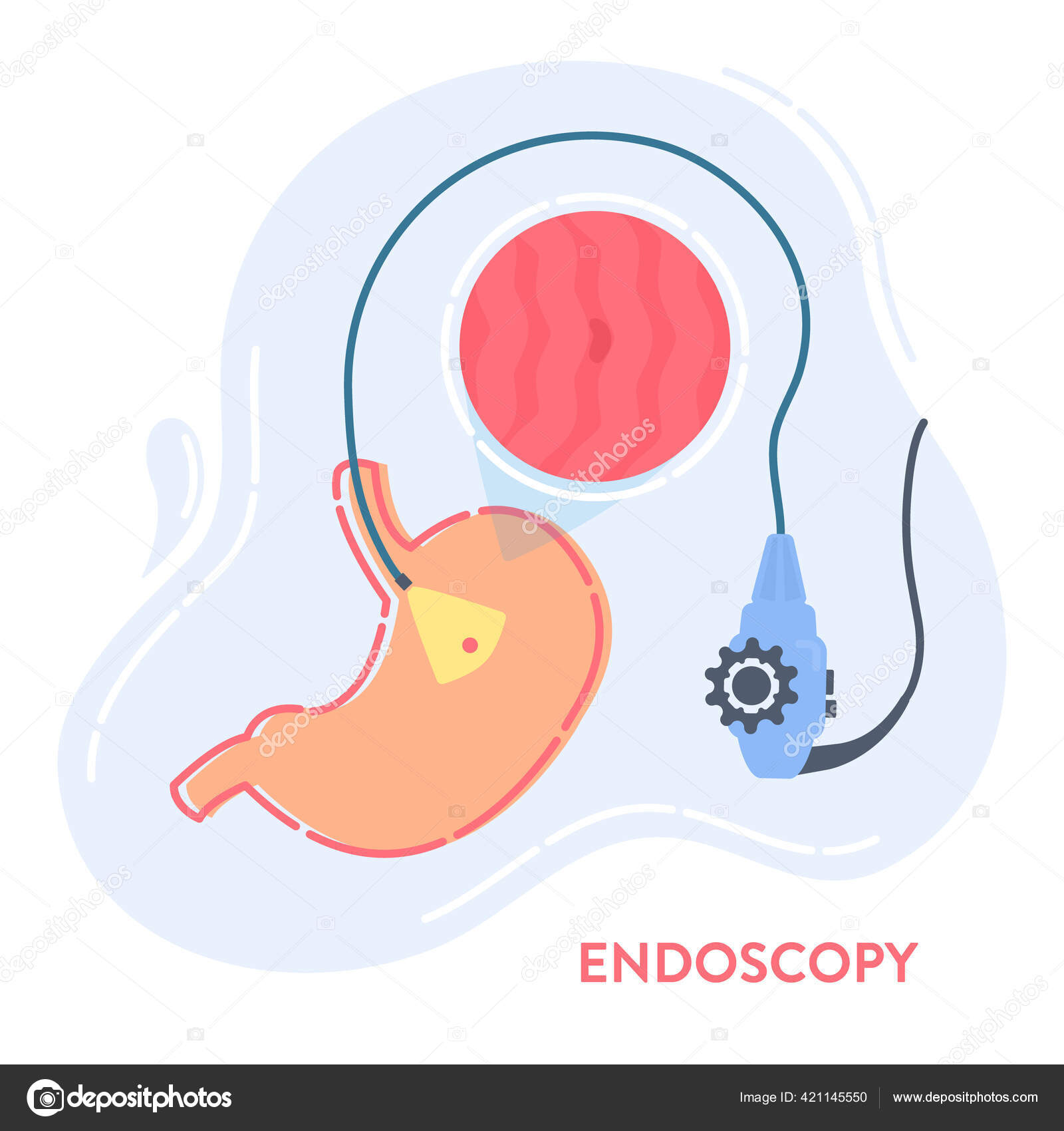 Equipo Procedimiento Endoscopia Para Diagnóstico Enfermedades ...