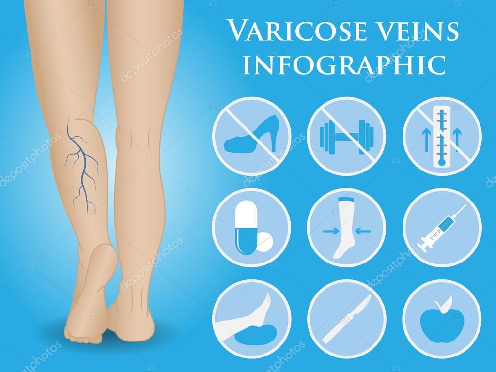 infografías vectoriales flebología 2024