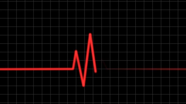 Electrocardiogram. Heartbeat waves — Stock Video © Nadezhda2000 #118290206
