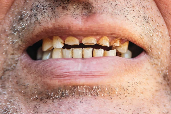 Yellow teeth Images - Search Images on Everypixel