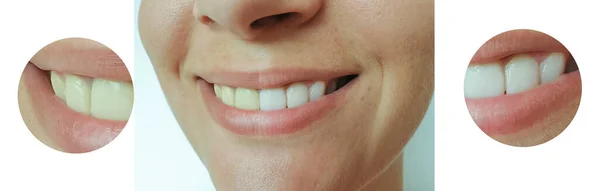 Colgate Stock Photos, Royalty Free Colgate Images | Depositphotos