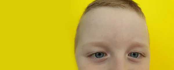 Síndrome de autismo Stock Photos, Royalty Free Síndrome de autismo ...