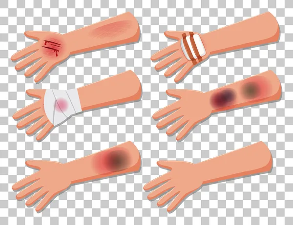 Arm Injury Clipart