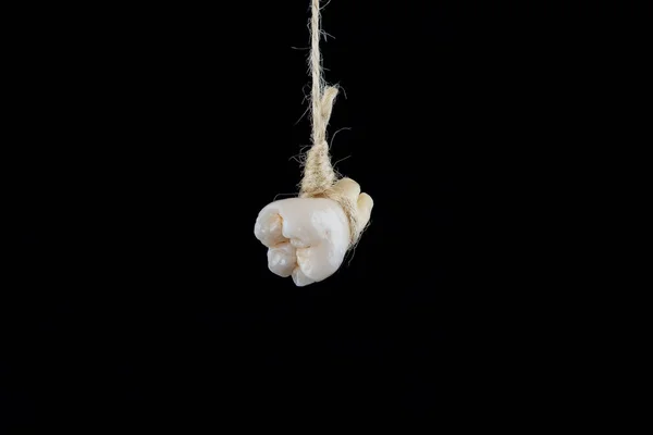 Tooth extracting method. Real human wisdom tooth hanging on thread ...